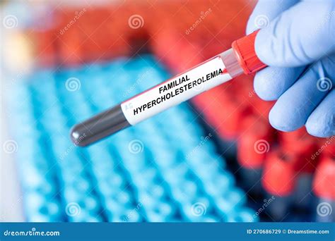 Familial Hypercholesterolemia Familial Hypercholesterolemia Disease