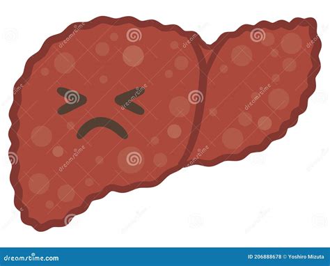 Cirrhosis Vector Illustration Labeled Medical Diagram With Illness
