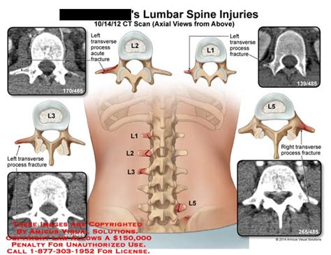 Medical Exhibits Demonstrative Aids Illustrations And Models