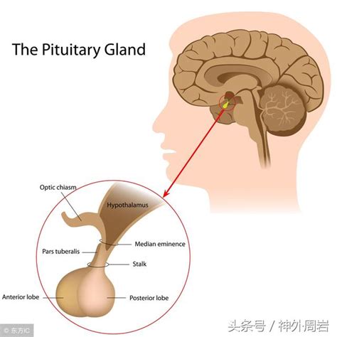 老年人為什麼越老越多的罹患無功能的垂體腺瘤？ 每日頭條