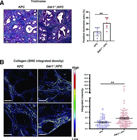 The Absence Of Discoidin Domain Receptor 1 Ddr1 Alters The Fibrotic Download Scientific