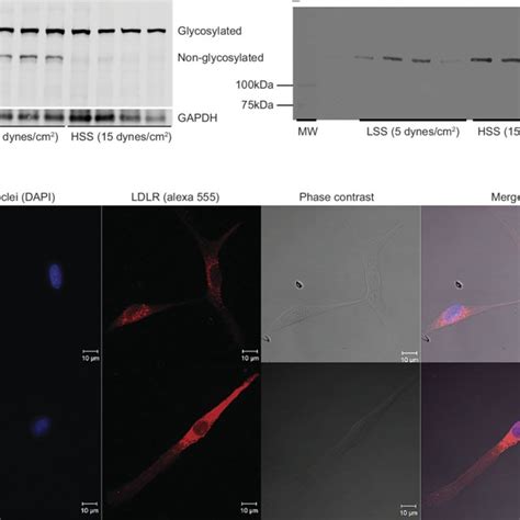 Low Density Lipoprotein Receptor LDLR Is Modulated In Endothelial