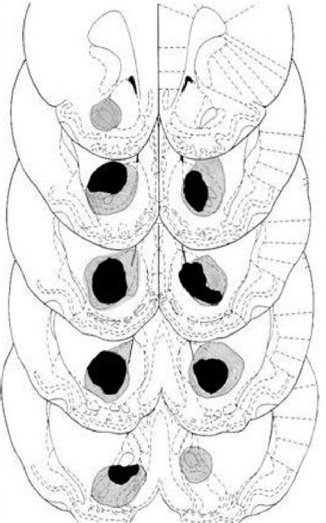 Figure 2 From The Role Of The Nucleus Accumbens Core In Impulsive