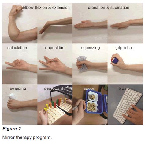 The Effect Of Mirror Therapy On Functional Recovery Of Upper Extr