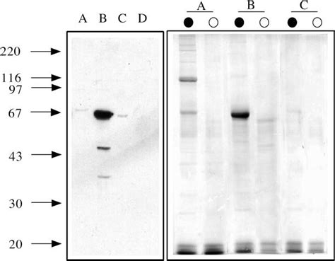 Western Blot Analysis Of Estrogen Receptor In The Nuclear Extract