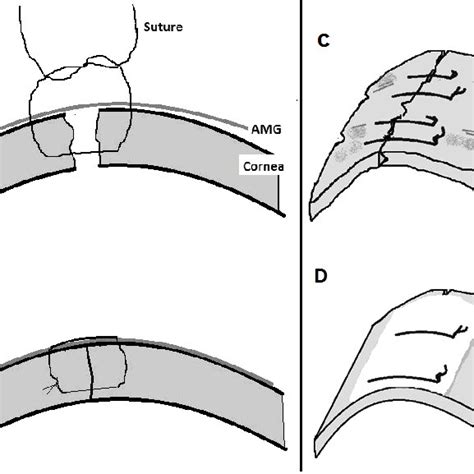 Corneal Staining Grading Areas 1 Central 2 Nasal 3 Temporal