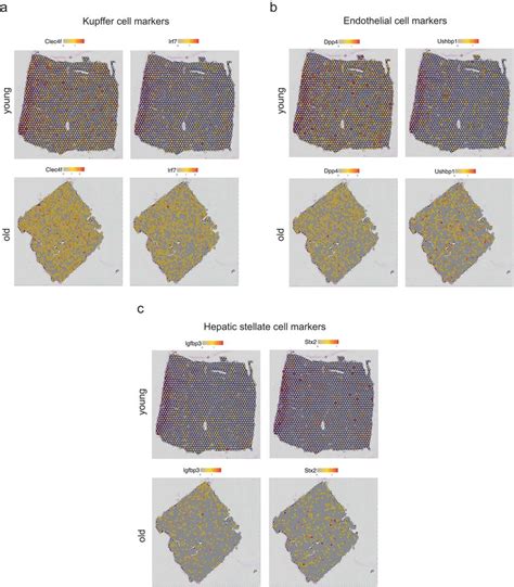 Non Parenchymal Cells In The Spatial Transcriptomics Download