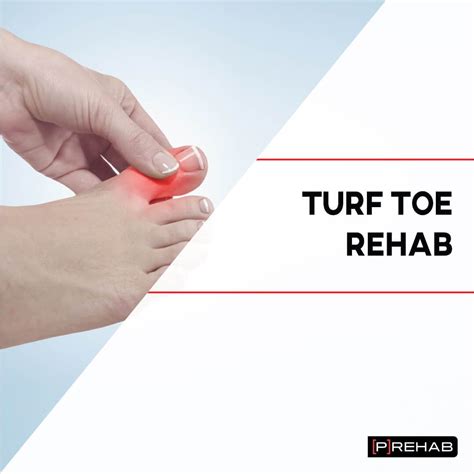 The Best Turf Toe Exercises Artofit