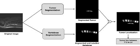 Figure 6 From Lumbar Spine Tumor Segmentation And Localization In T2 Mri Images Using Ai