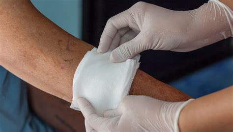 What Everyone Should Know About How To Stop Bleeding