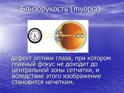 Близорукость и ее профилактика презентация онлайн
