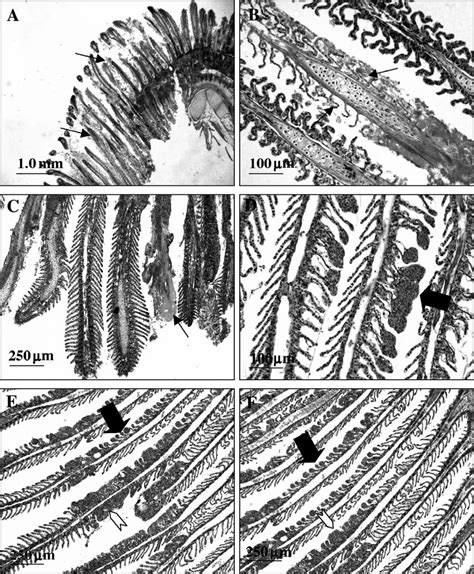 Salmo Salar Infected With Tenacibaculum Maritimum Ab Extensive