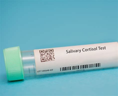 Why Its Important To Test Cortisol Levels At Specific Times At Home