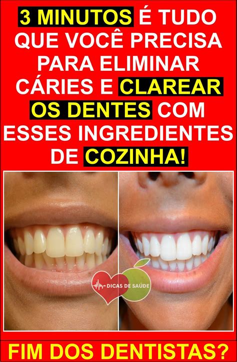 3 Minutos é Tudo Que Você Precisa Para Eliminar Cáries E Clarear Os