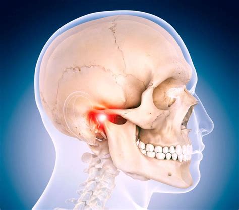 Tmj Dysfunction