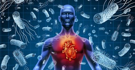 Staphylococcus Aureus Endocarditis A Selection Of