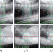 Comparing Pixel Density Differences Among Real Time X Ray Images Of A Download Scientific