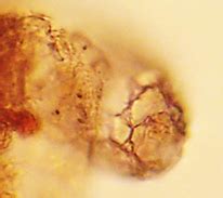 Difflugia Pecac Tecamebas