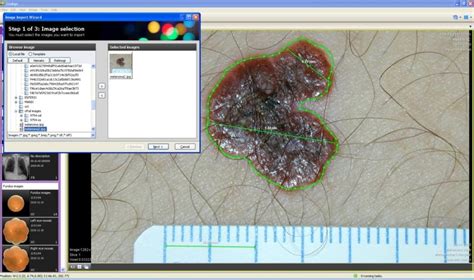 17 top open source free dicom viewers for medical professionals