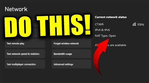 How To Change Xbox Series X S Nat To Open And Fix Strict Connection