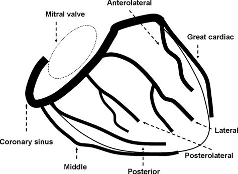 Coronal Sinus Anatomy