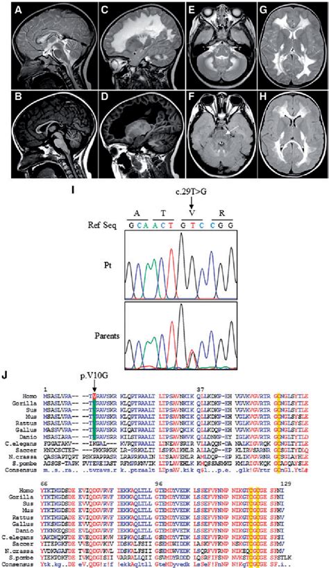 Multiple Mitochondrial Dysfunctions Syndrome 4 Semantic Scholar