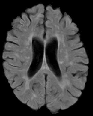 Tensorflow Masking Of MRI In Python Stack Overflow