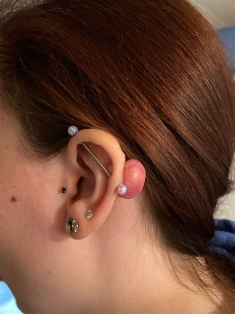 Keloid Industrial Piercing