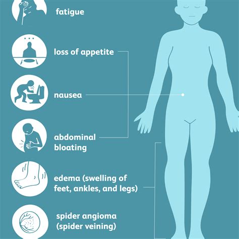 Cirrhosis Overview And More