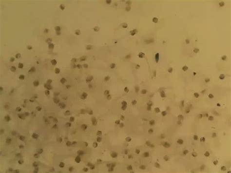 Video Mass Production Of Genetically Modified Aedes Aegypti For Field Releases In Brazil