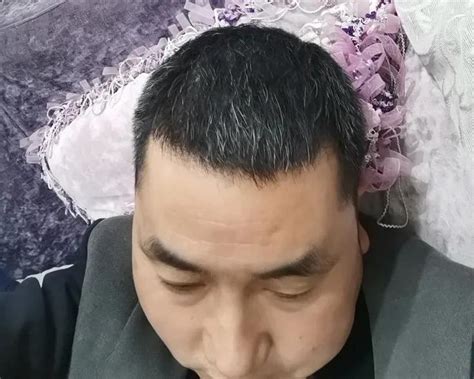 感觉男人40岁衰老的比较快