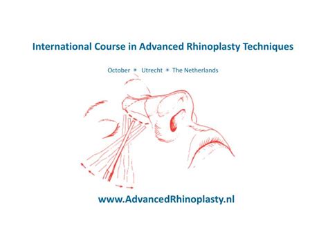 Dirk Jan Menger On Linkedin International Course In Advanced Rhinoplasty Techniques Utrecht The…