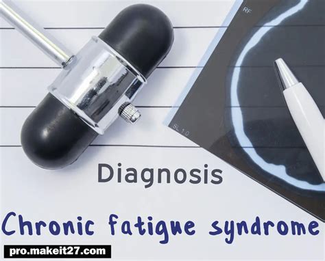 Cfs 의학용어 D T 의학용어 Sdh 의학용어 Pro27