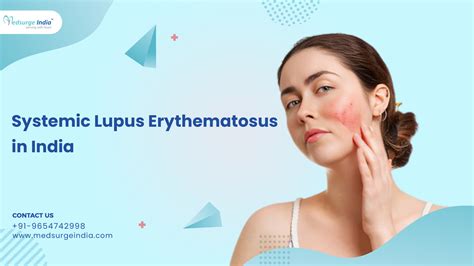 Systemic Lupus Erythematosus Cost In India Medsurge India