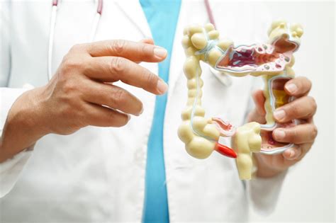 Infectious Colitis Symptoms Causes And Treatment Strategies