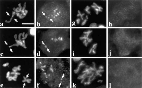 Dhc Fails To Localize To The Kinetochore In Zw10 Or Rod Mutant Larval Download Scientific