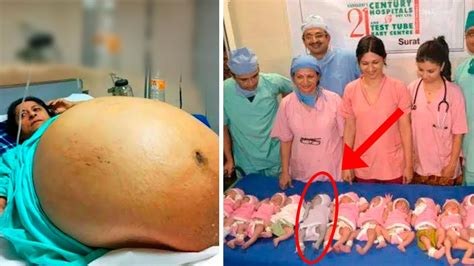Mãe Dá à Luz a 10 Bebês e Médicos Percebem Que Um Deles Não é um Bebê