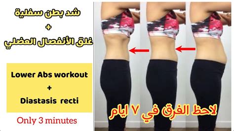 تمارين التخلص من البطن السفلية وكرش الولادةعلاج الانفصال العضلي Lower