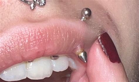 Angel Fangs Bump R Piercing