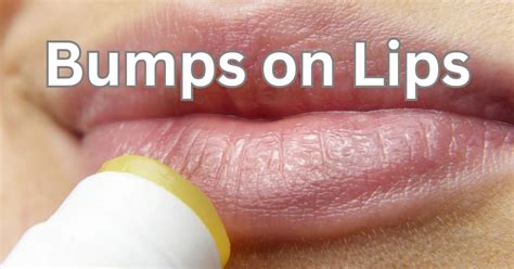 Bumps On The Lips Causes Symptoms And Effective Treatment