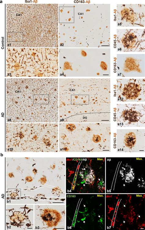 Only Abeta Plaques From Ad Hippocampus Are Infiltrated With