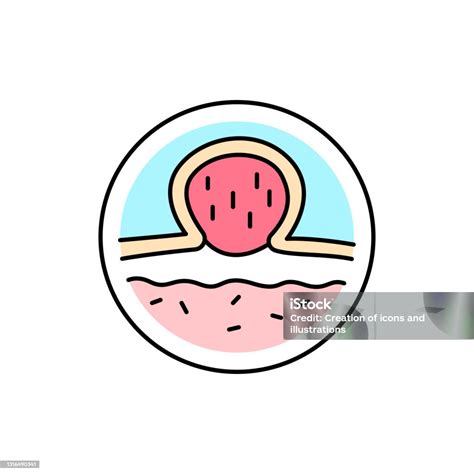 표겐성 육아종 색상 선 아이콘 피부과 질환 격리된 벡터 요소입니다 0명에 대한 스톡 벡터 아트 및 기타 이미지 0명 개념