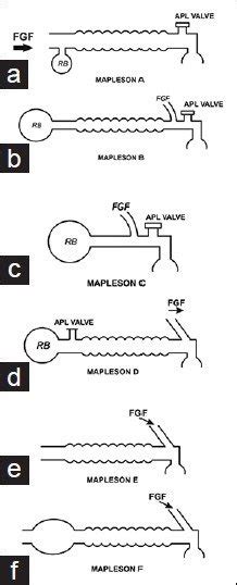 Types Of Mapleson Circuits