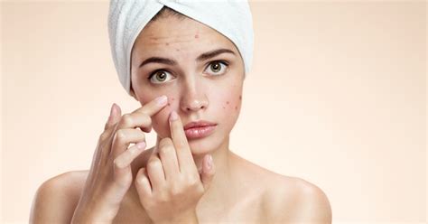 How Professional Acne Treatments Outperform Home Remedies