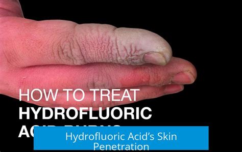 Hydrofluoric Acid Understanding Its Danger Despite Being A Weak Acid Chemcafe — Science