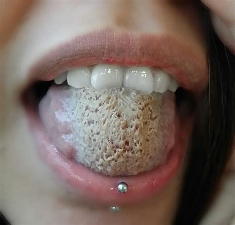 Gross Skin Conditions