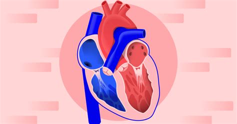 Hypertrophic Cardiomyopathy And Your Body