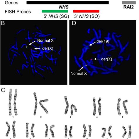 Balanced X Autosome Translocation Disrupts The Nhs Gene A Cma Analysis Download Scientific