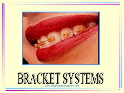 Bracket System 1 Ppt