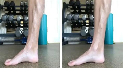 صافی کف پا Flat Feet بدن خوبا